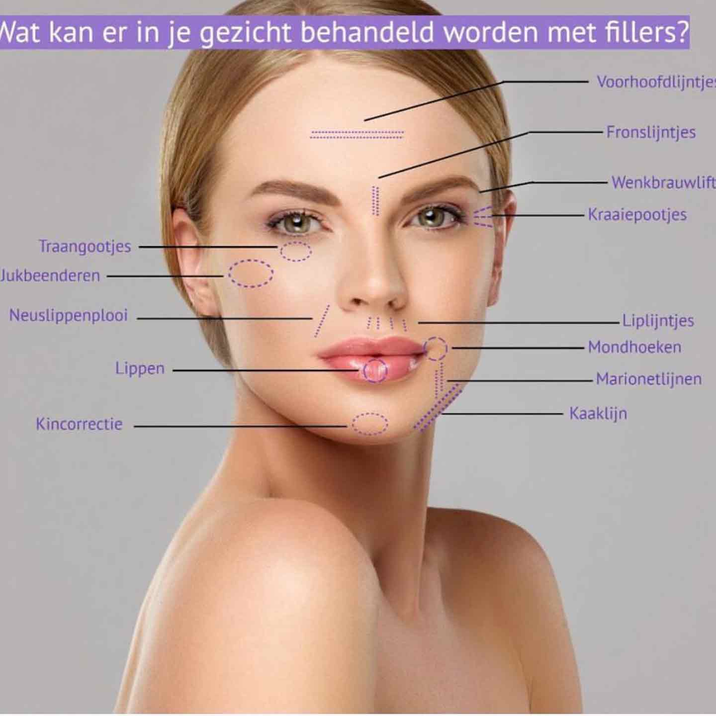 Fillers | Medical Skin Clinic